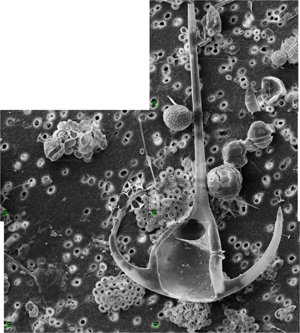Electron Microscopy: plankton biologist discovers new toy | Words in mOcean