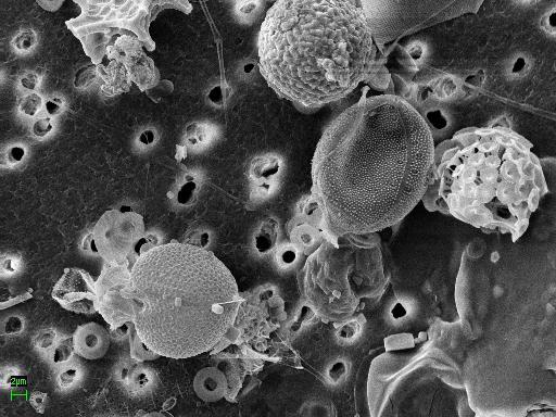 Electron Microscopy: plankton biologist discovers new toy | Words in mOcean